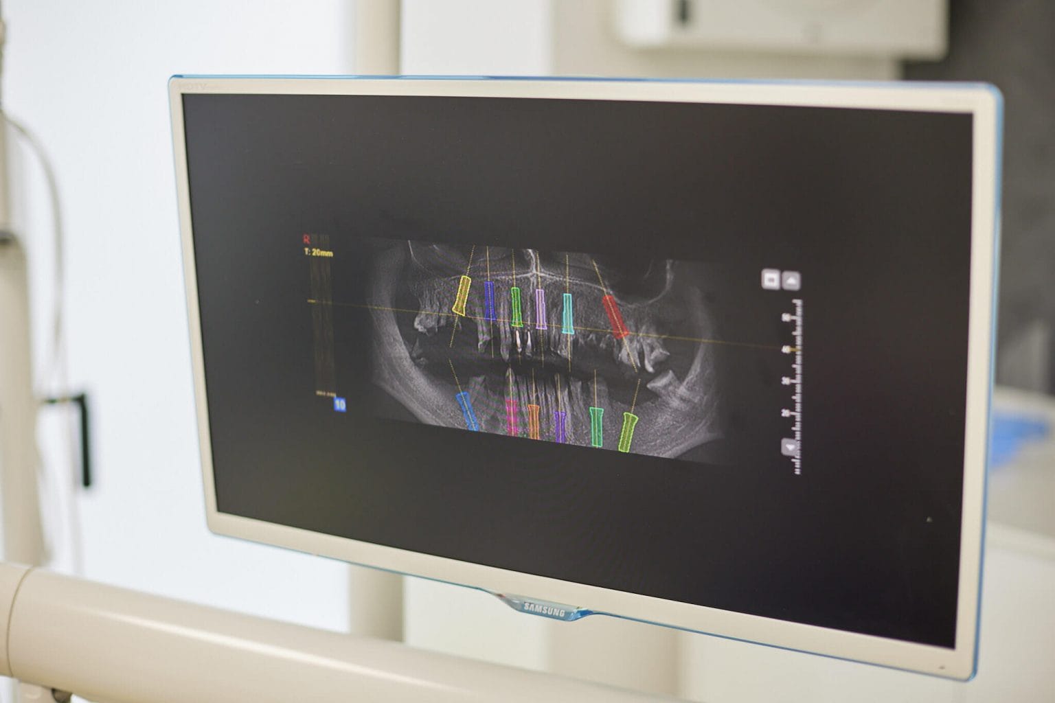 Radiografie Dentara Sector 4 Bucuresti | Clinica Dentaline